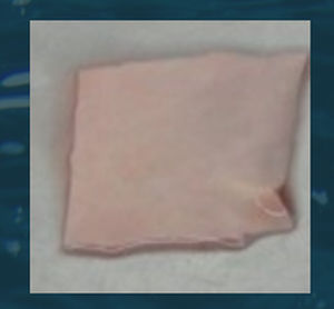 Matriz tisular cirugía cardíaca - CenoBiologics - alotrasplante