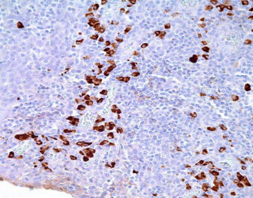 Reactivo de inmunoglobulina A - CIR-0101 - Celnovte Biotechnology Co ...