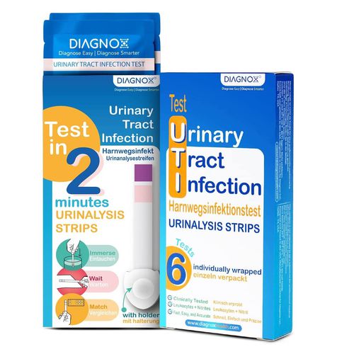 Tira de prueba de infección de las vías urinarias - Urinox - Diagnox ...
