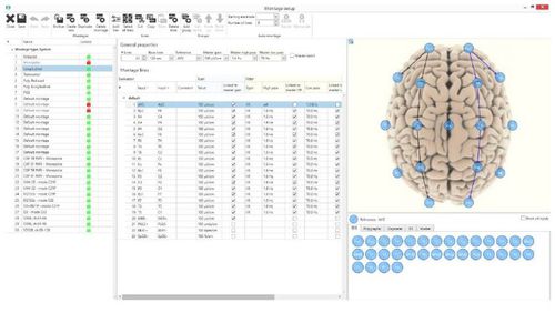 Software para EEG - BRAIN QUICK® - Natus Micromed - de gestión / de ...
