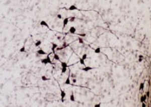 Reactivo oxitocina - RA24604 - Neuromics - anticuerpos / de suero ...