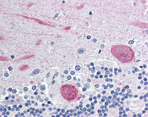 Reactivo anticuerpos - RA30051 - Neuromics - para inmunohistoquímica ...