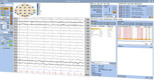 Software para EEG - DEYMED Diagnostic - de adquisición / de ...