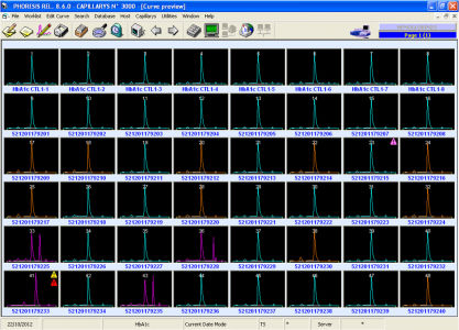 Software para electroforesis - PHORESIS CORE - Sebia - de laboratorio ...