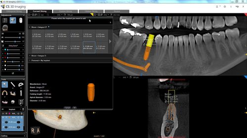 Software ortodóntico - Carestream Dental - para cirugía dental / para imagen dental / de gestión