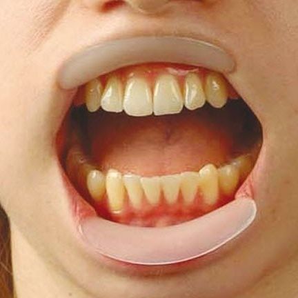 Retractor bucal - Spandex® -Vertical - Hager & Werken - labial / dental ...