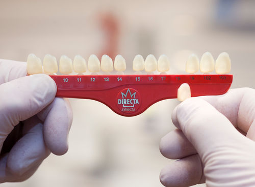 Corona dental policarbonato - Directa - DIRECTA AB - molares / translúcido