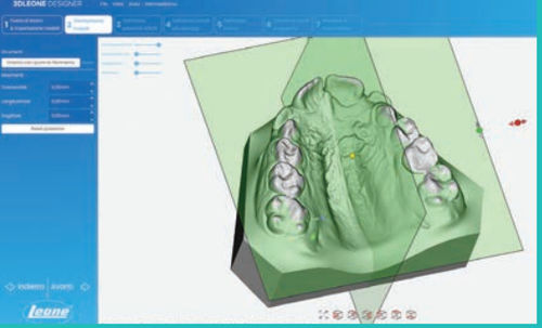 Software de diseño - LEONE S.p.a. - de CAD / FAO / de laboratorio dental