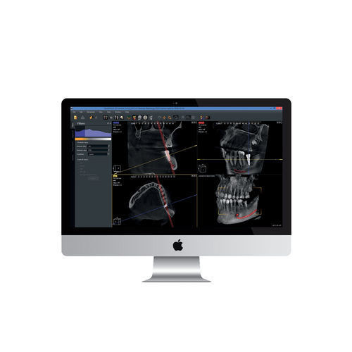 Software de análisis cefalométrico - Owandy Radiology - de diagnóstico / de medición / de ...