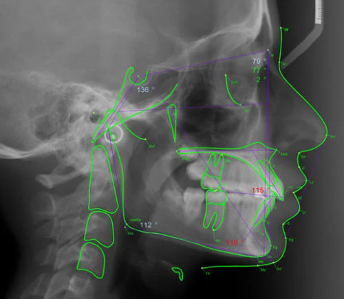 Software de análisis cefalométrico - Romexis® - Planmeca - de planificación / de tratamiento ...