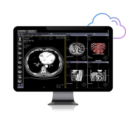 PACS procesos basados en la web - Smart Net - Infinitt Healthcare - médico