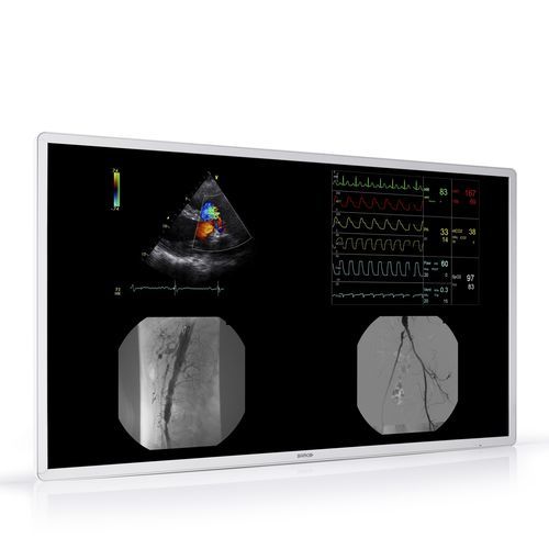 Monitor de radiología - MDAC-8355 - Barco - de alta definición / 4K / 4K