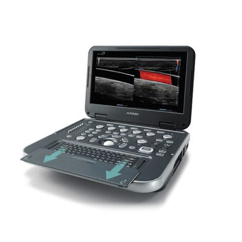 Ecógrafo portátil - E-CUBE i7 - Alpinion Medical Systems - para ecografía polivalente / doppler ...