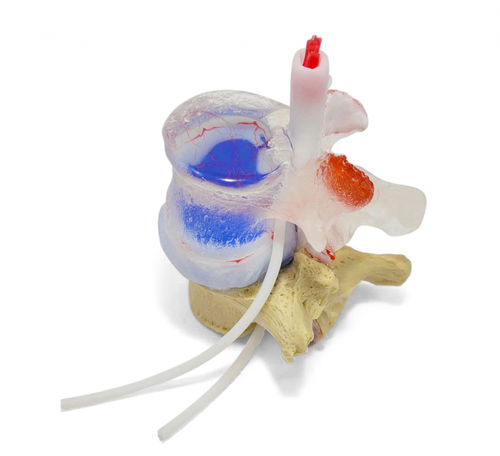 Modelo anatómico de discos intervertebrales - True Blue Professional ...
