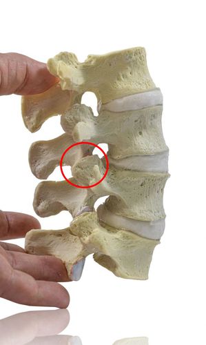 Modelo anatómico de hueso - L2-5 - Dynamic Disc Designs Corp. - de ...