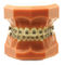 Bracket de metal - Synergy FX® - Rocky Mountain Orthodontics (RMO®)