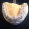 Material dental de PMMA - Clear - Hunan Vsmile Biotechnology Co. Ltd ...
