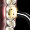 Detector de caries por transiluminación - Microlux™ - AdDent, Inc.