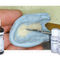 Material dental de PMMA - SR Ivocron - Ivoclar Vivadent - de composite ...