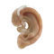 Prótesis estética esterna auricular - The Anaplastology Clinic - para ...