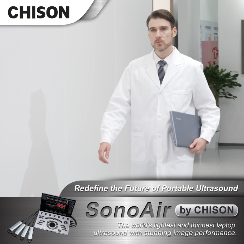 CHISON lanzó recientemente el SonoAir de ultrasonido portátil más ...