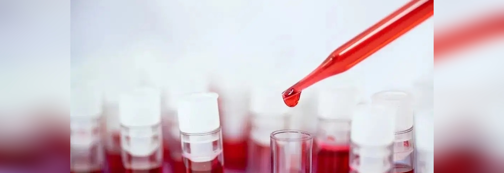 La importancia clínica de la VSG - Changping District, Beijing, China ...