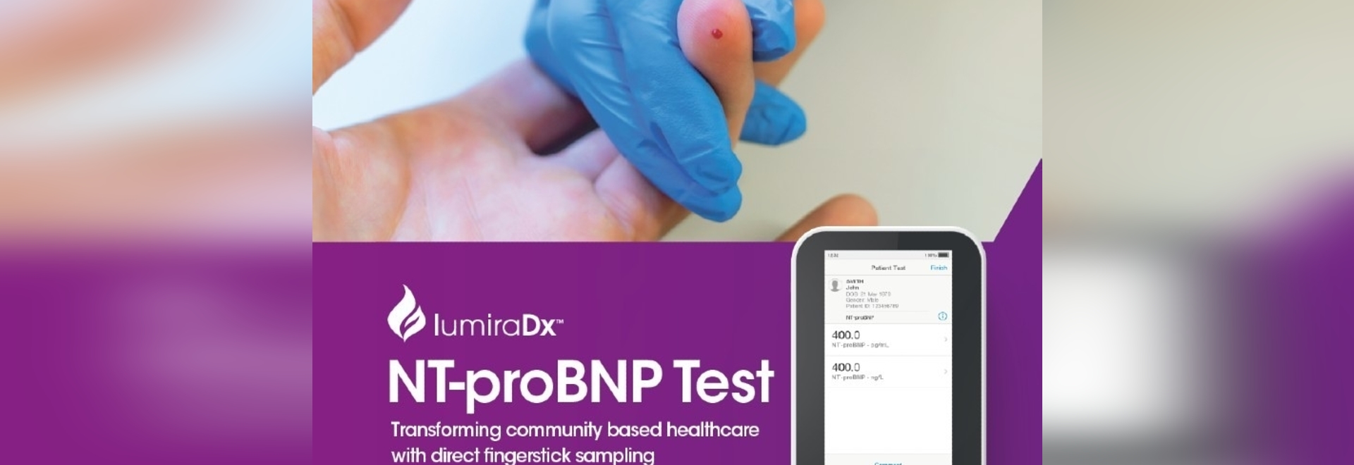 LumiraDx anuncia el envío comercial de su prueba NT-proBNP de punto de atención en Europa ...