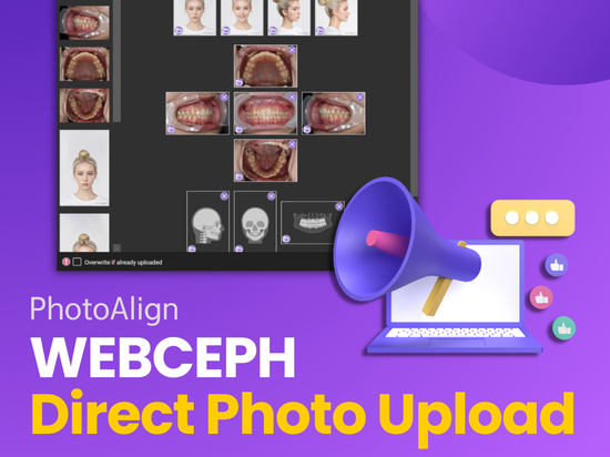 Lista de noticias y trends de la empresa PhotoAlign